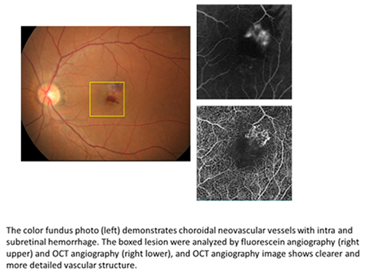 Ophthalmology/Protective Care for Sensory Disorders - Head and Neck and ...