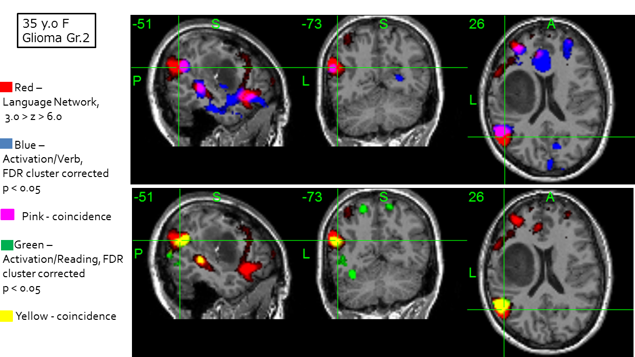 脳神経外科学 | 脳とこころの研究センター