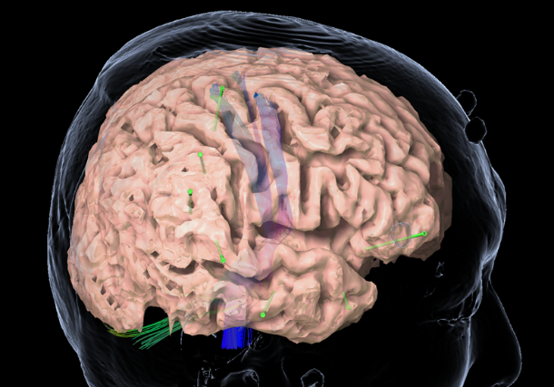 脳神経外科学 | 脳とこころの研究センター
