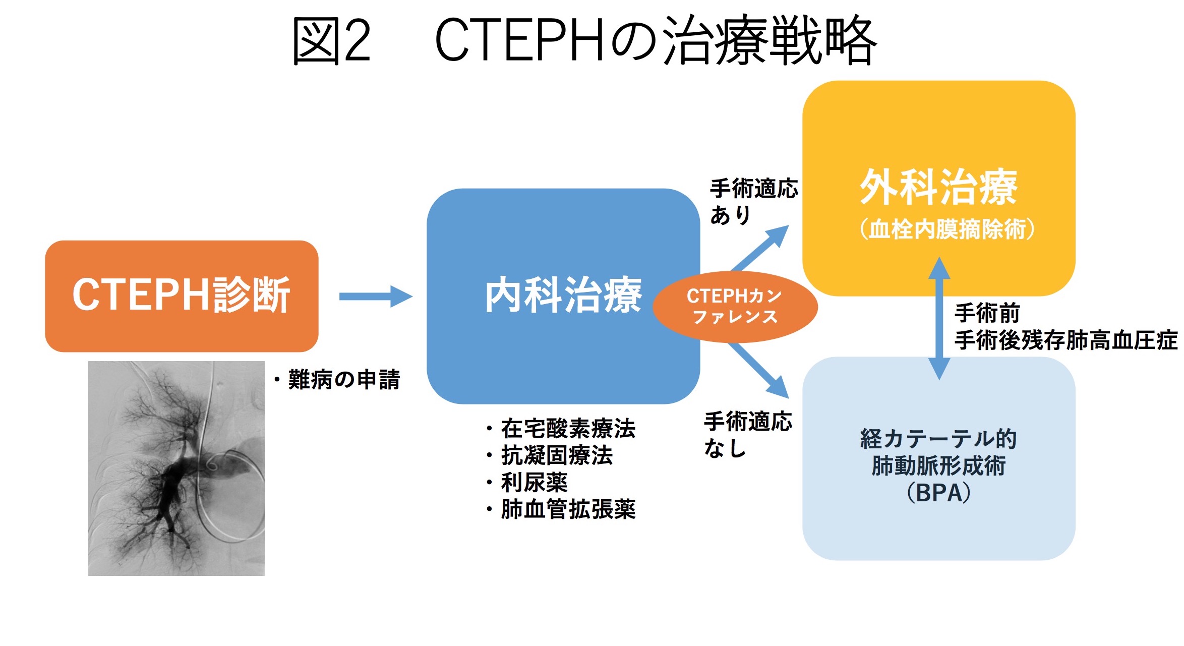 慢性血栓塞栓性肺高血圧症（CTEPH）に対する肺動脈拡張術（BPA） | 名古屋大学附属病院ハートチーム
